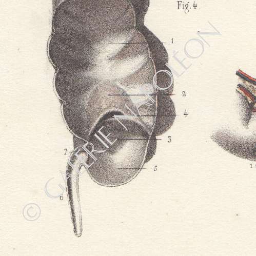 Antique Prints & Drawings | Human Body - Anatomy - Duodenum and Coecum ...